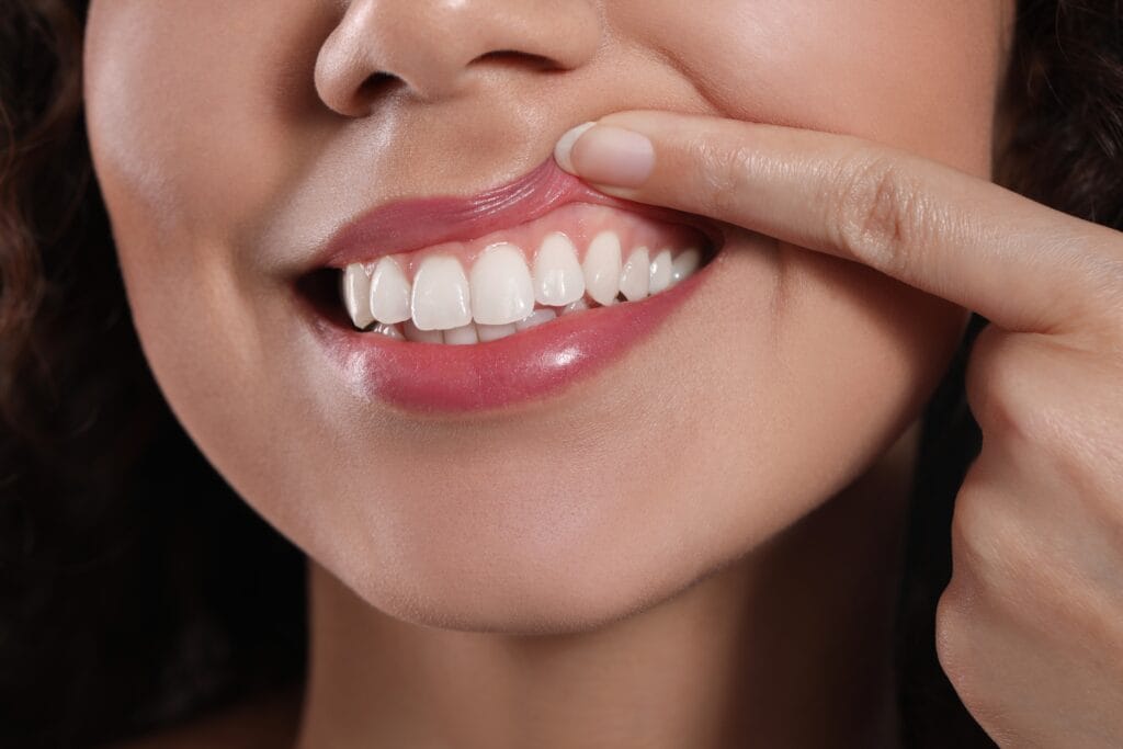 Gum Health